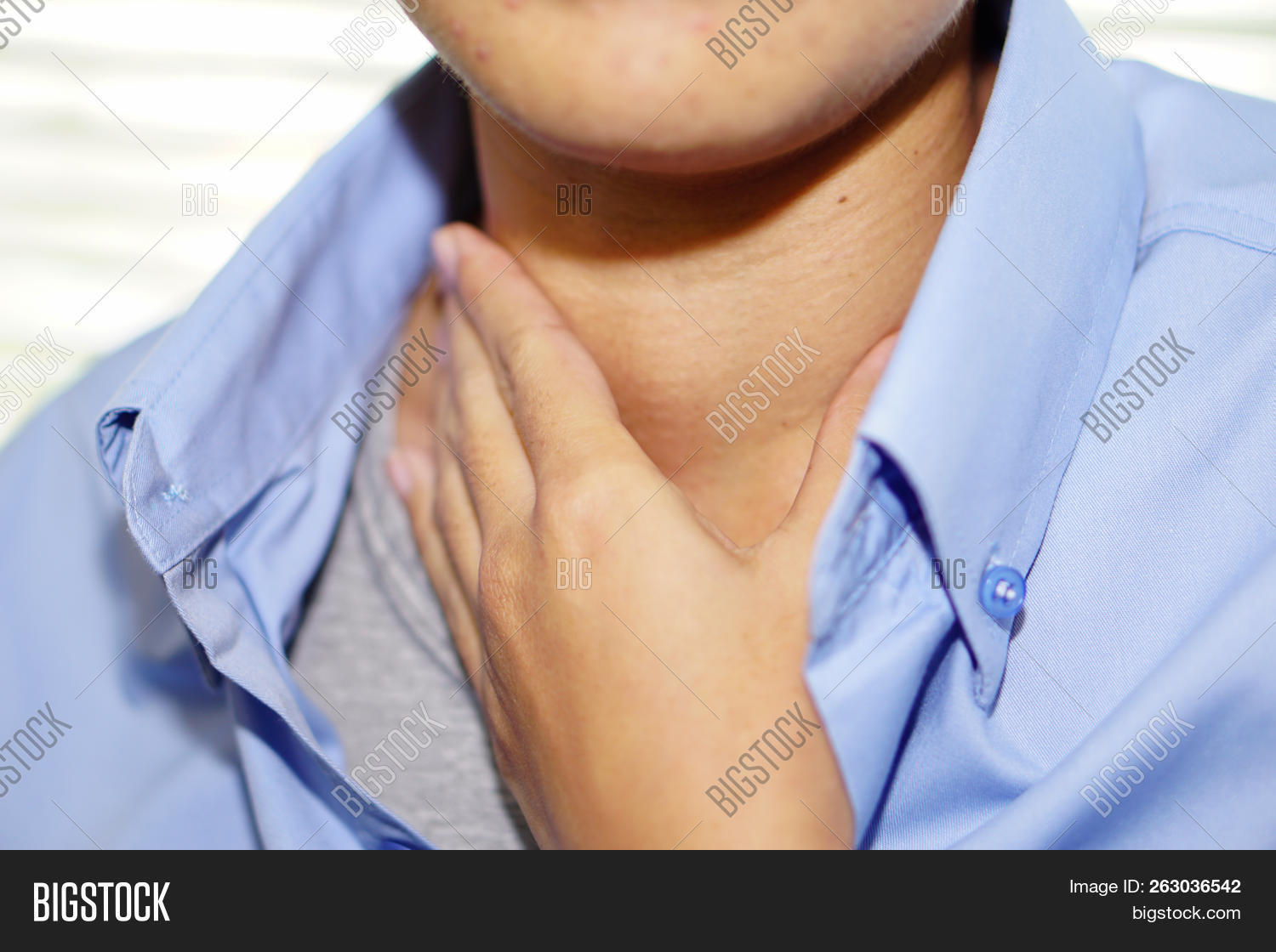 Asian Lady Woman Patient Have Abnormal Enlargement Of Thyroid Gland ...