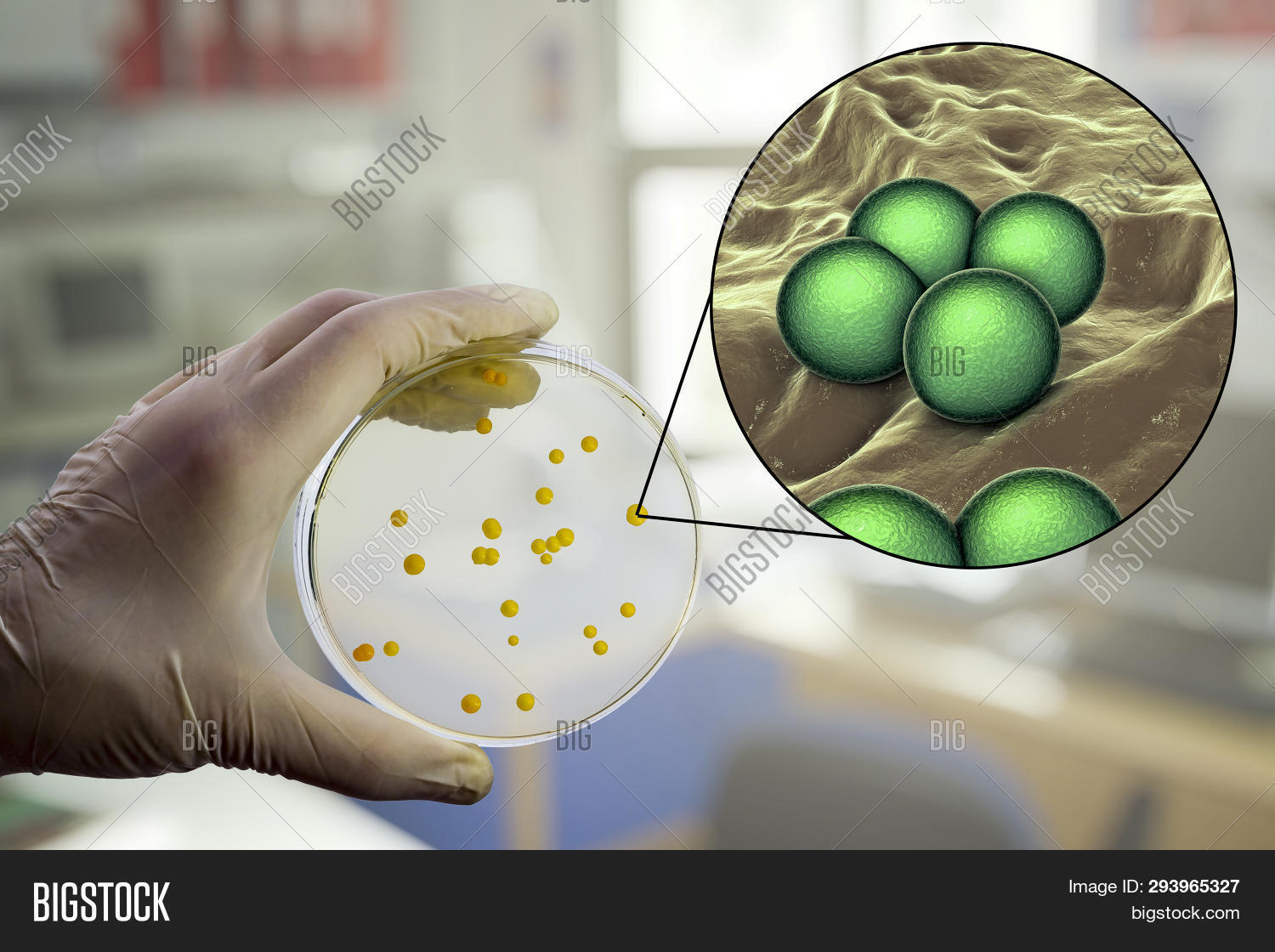 Colonies Of Micrococcus Luteus Bacteria On Agar Plate And Close Up View ...