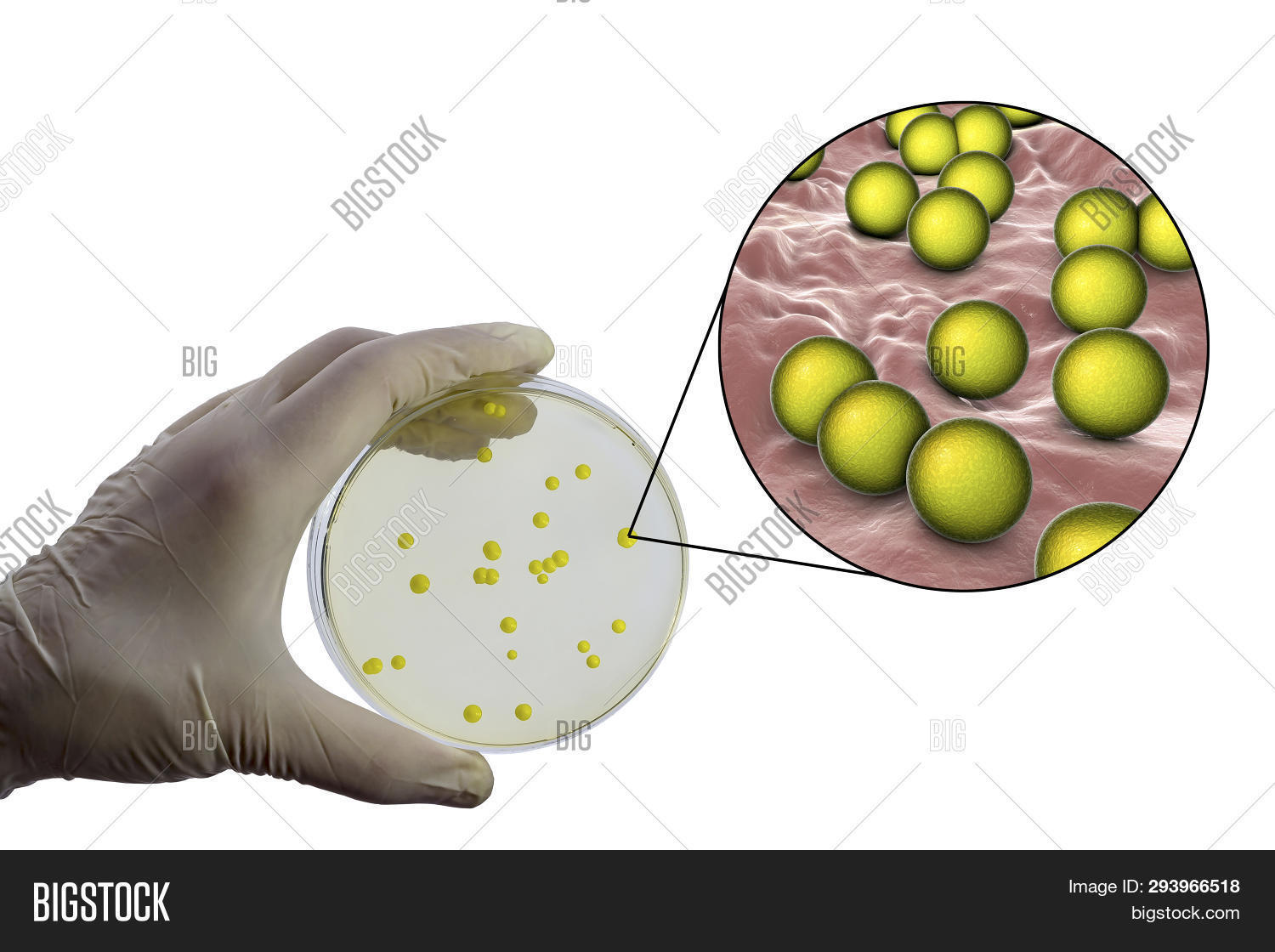 Colonies Of Micrococcus Luteus Bacteria On Agar Plate And Close Up View ...