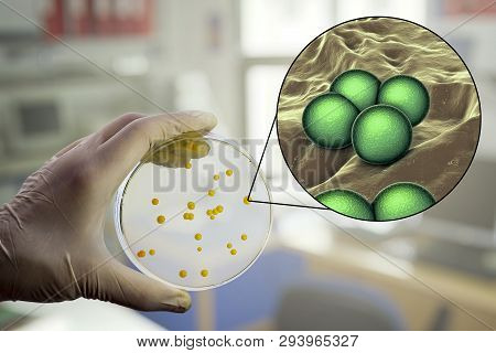 Colonies Of Micrococcus Luteus Bacteria On Agar Plate And Close Up View ...