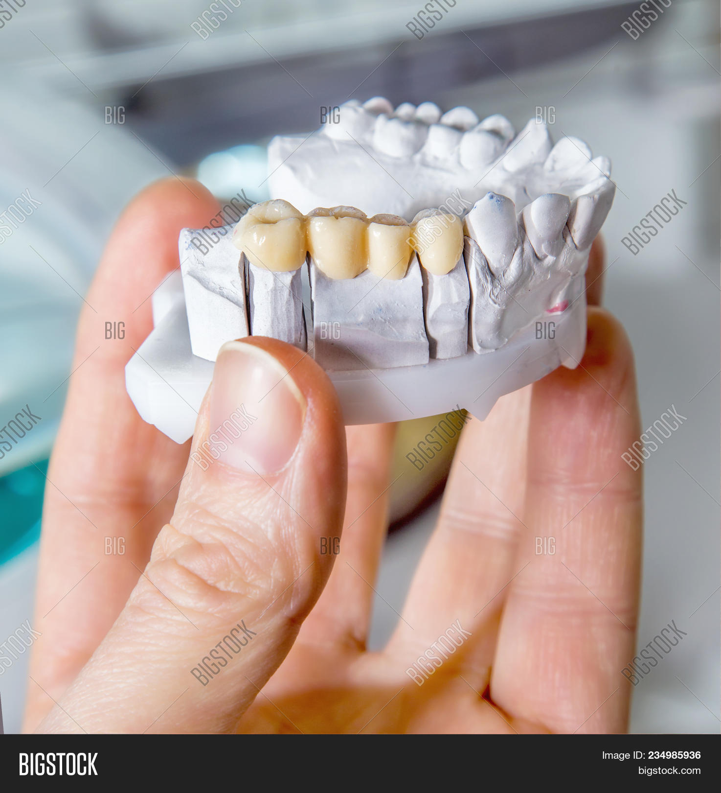 Technical Shots Of Model On A Dental Prothetic Laboratory.dentist Hand ...