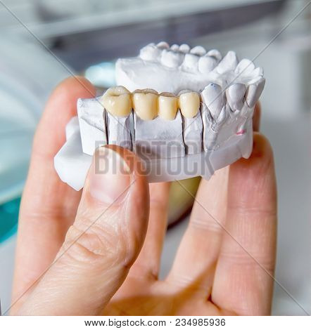 Technical Shots Of Model On A Dental Prothetic Laboratory.dentist Hand ...