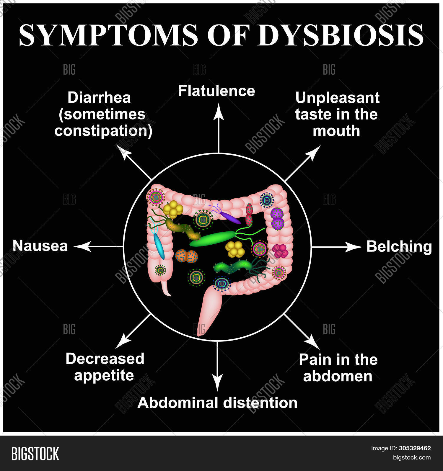 Symptoms Of Dysbiosis. Dysbacteriosis Of The Intestine. The Large ...