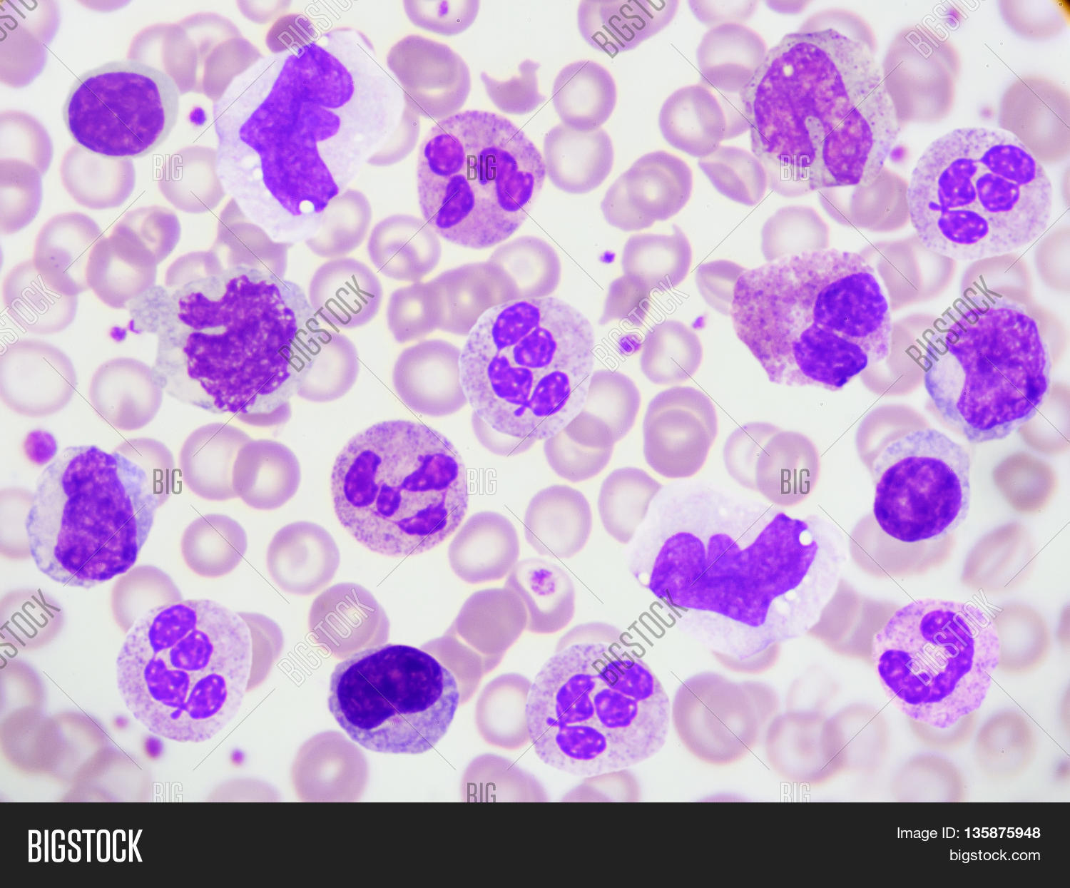 Human White Blood Cells Labeled