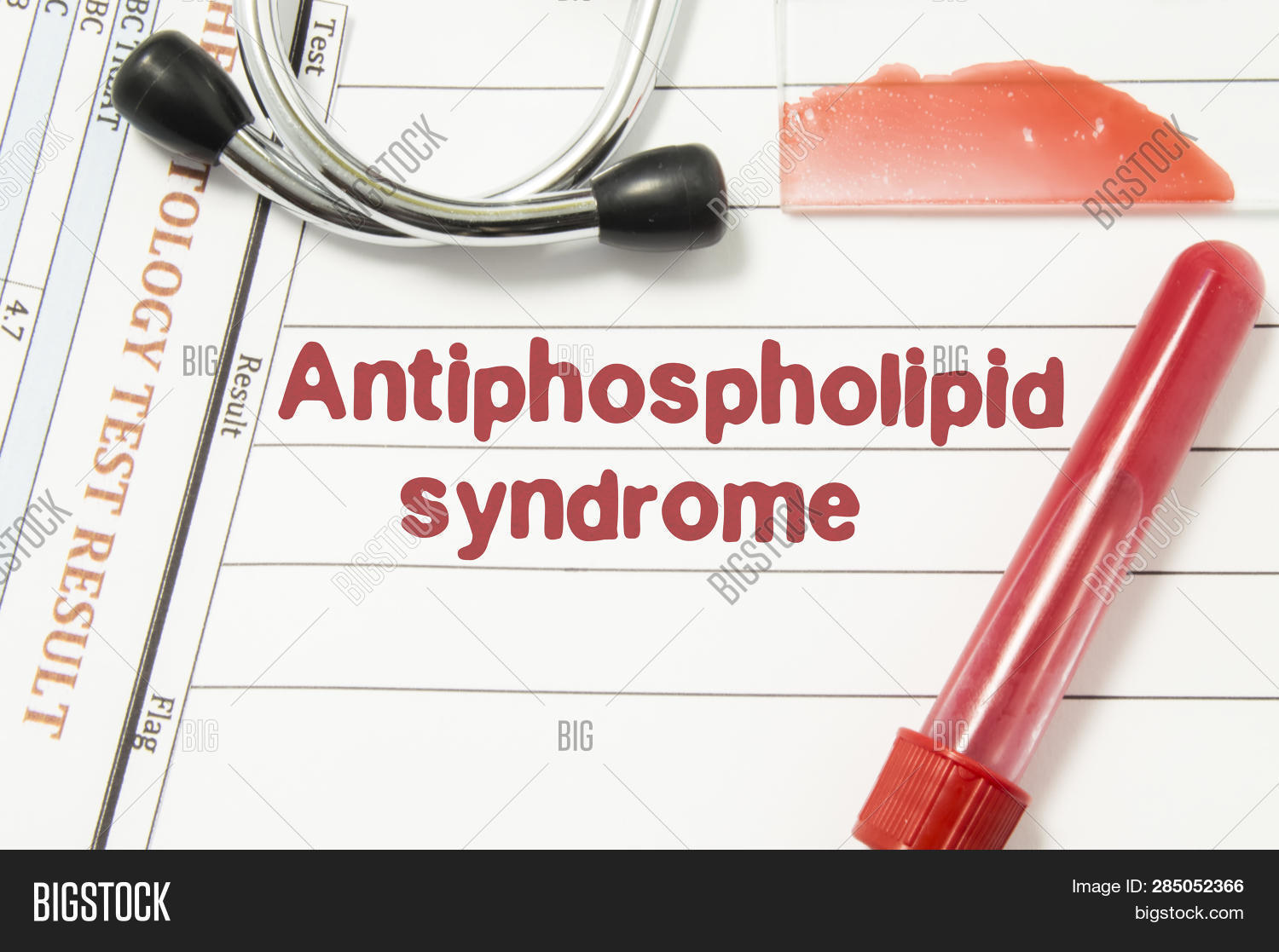 Diagnosis Of Antiphospholipid Syndrome. Laboratory Blood Bottle, Glass ...