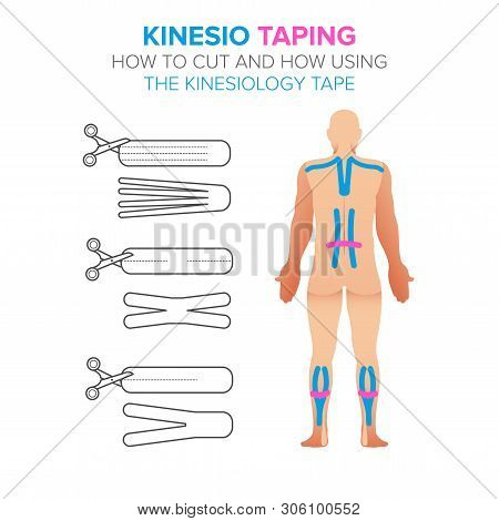 Kinesiology Taping Illustration. How To Cut And How Using The Kinesio ...