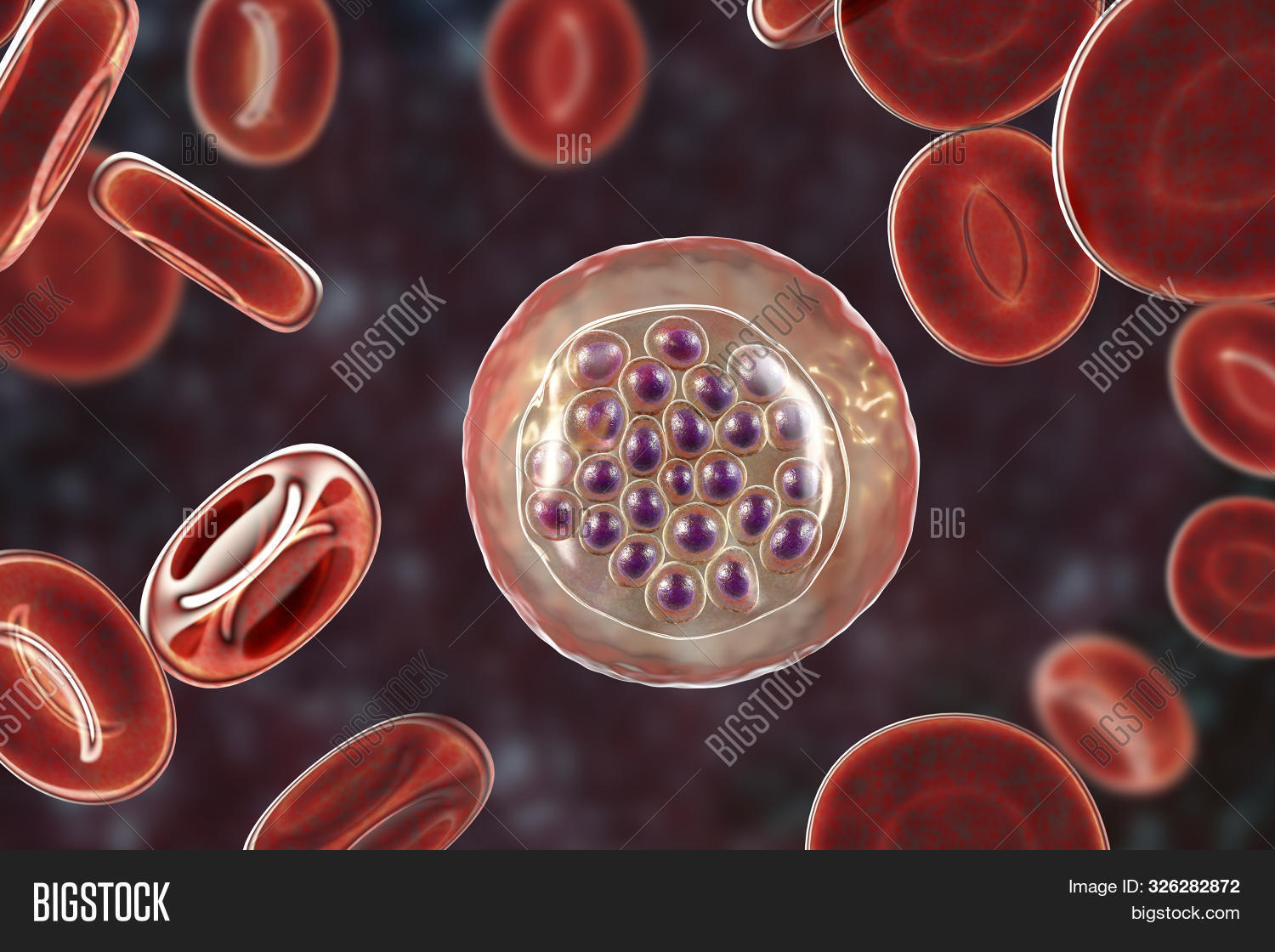 The Malaria-infected Red Blood Cells. 3d Illustration Showing Malaria ...