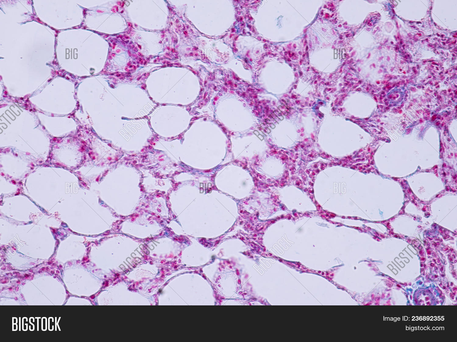 Human Lung Tissue Under Microscope View For Education Histology. Human ...