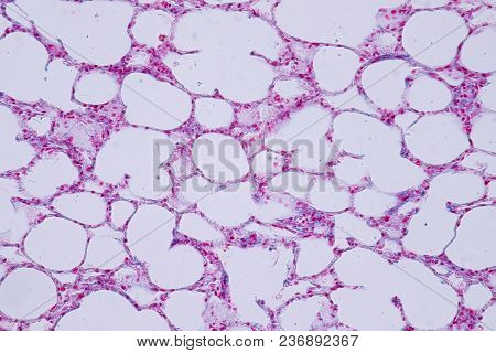Human Lung Tissue Under Microscope View For Education Histology. Human ...