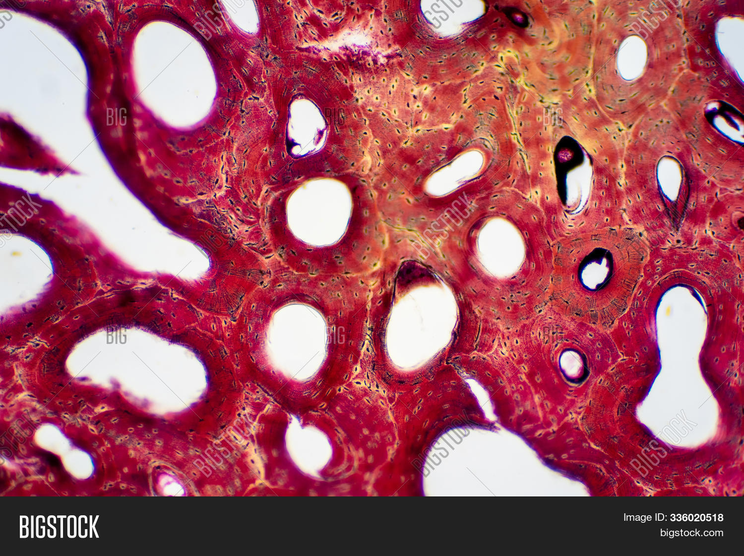 Histology Of Human Compact Bone Tissue Under Microscope View For ...