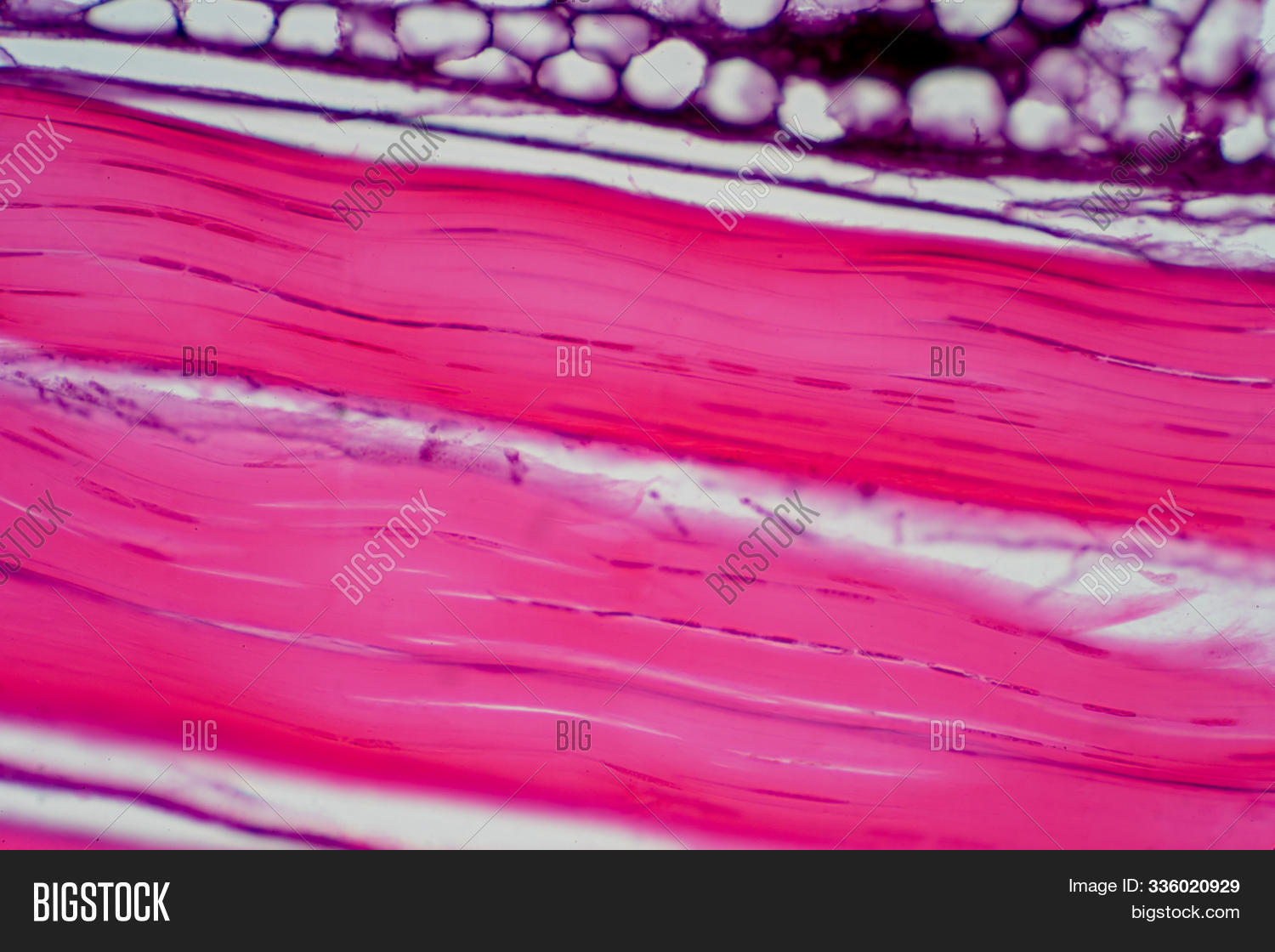 Cross Section Human Tendon Under Microscope View For Education ...