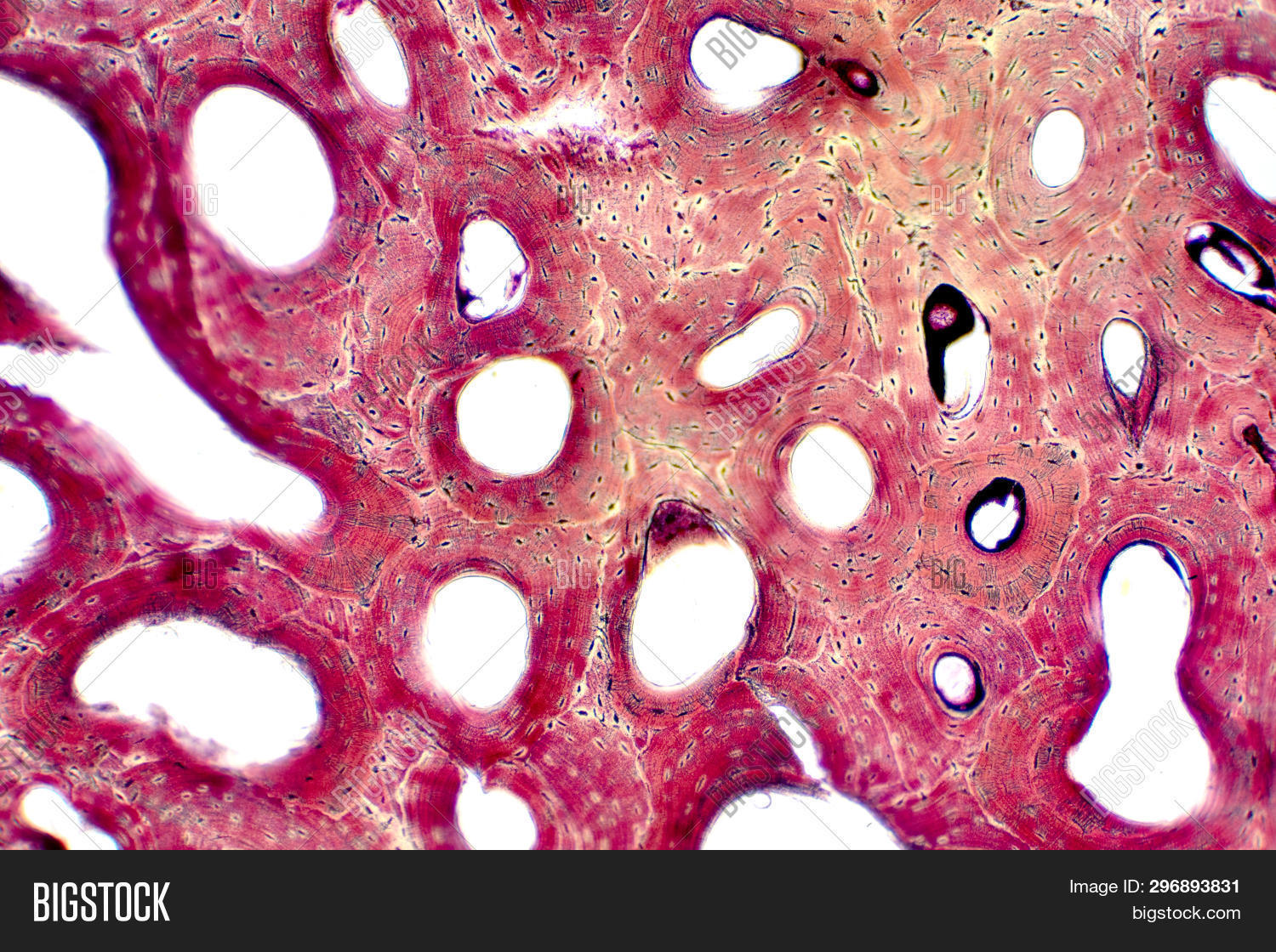 Histology Of Human Compact Bone Tissue Under Microscope View For ...