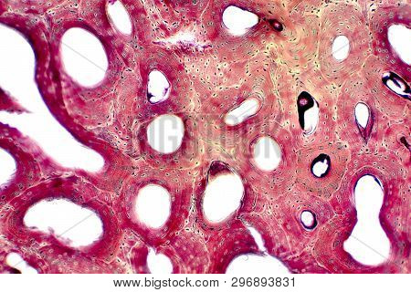 Histology Of Human Compact Bone Tissue Under Microscope View For ...