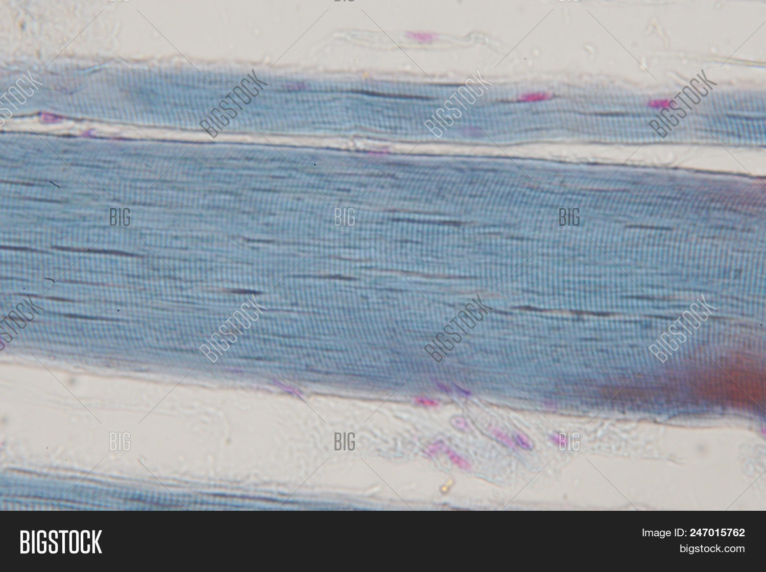 Human Skeletal Muscle Under Microscope View For Education Histology ...