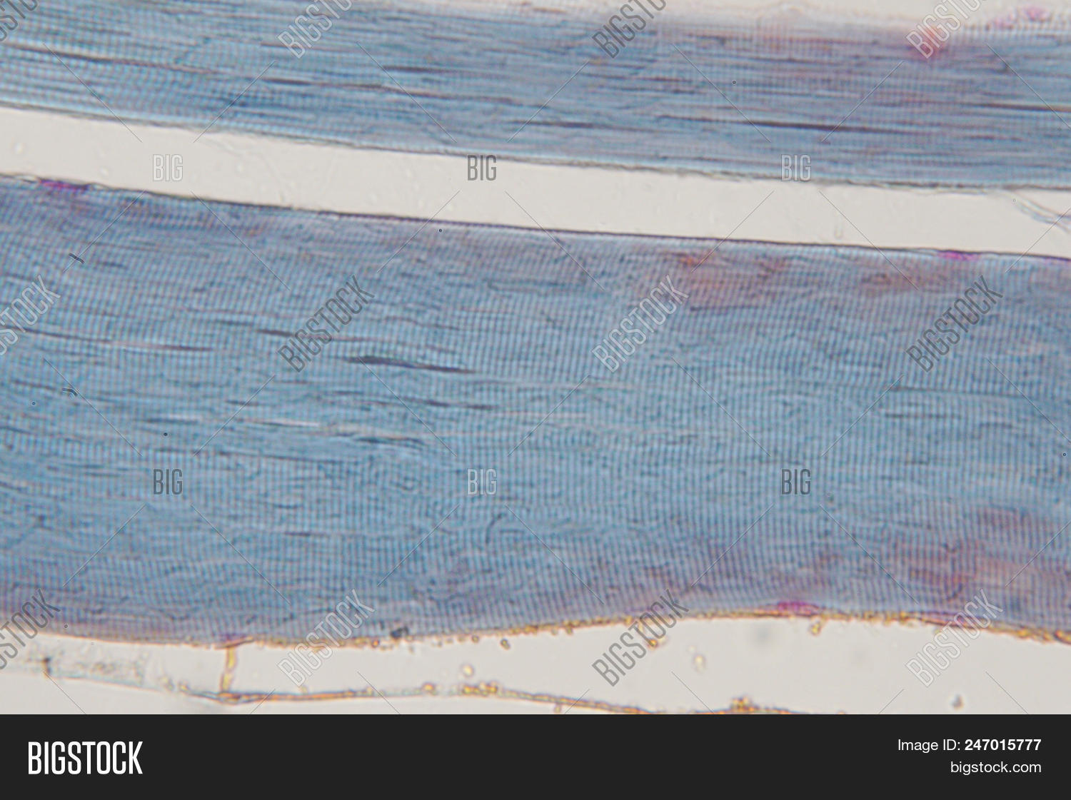 Human Skeletal Muscle Under Microscope View For Education Histology ...