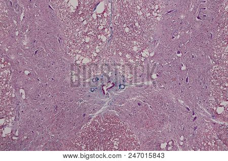 Neurons Cells From The Spinal Cord Under The Microscope View - Stock ...