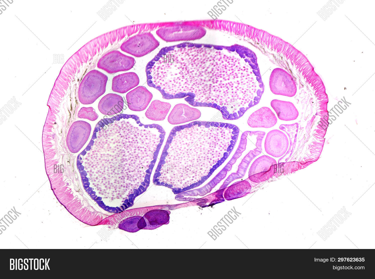 Microscope Photo Of Parasitic Nematode Worm Ascaris Sp. Cross Section ...