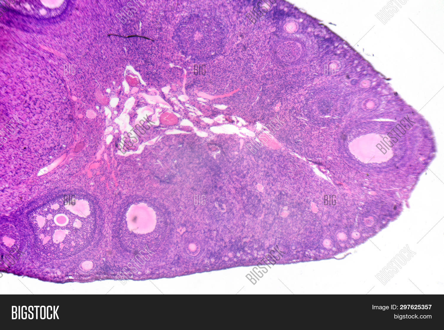 Micrograph Of Ovary Showing Primordial, Primary And Secondary Follicles ...