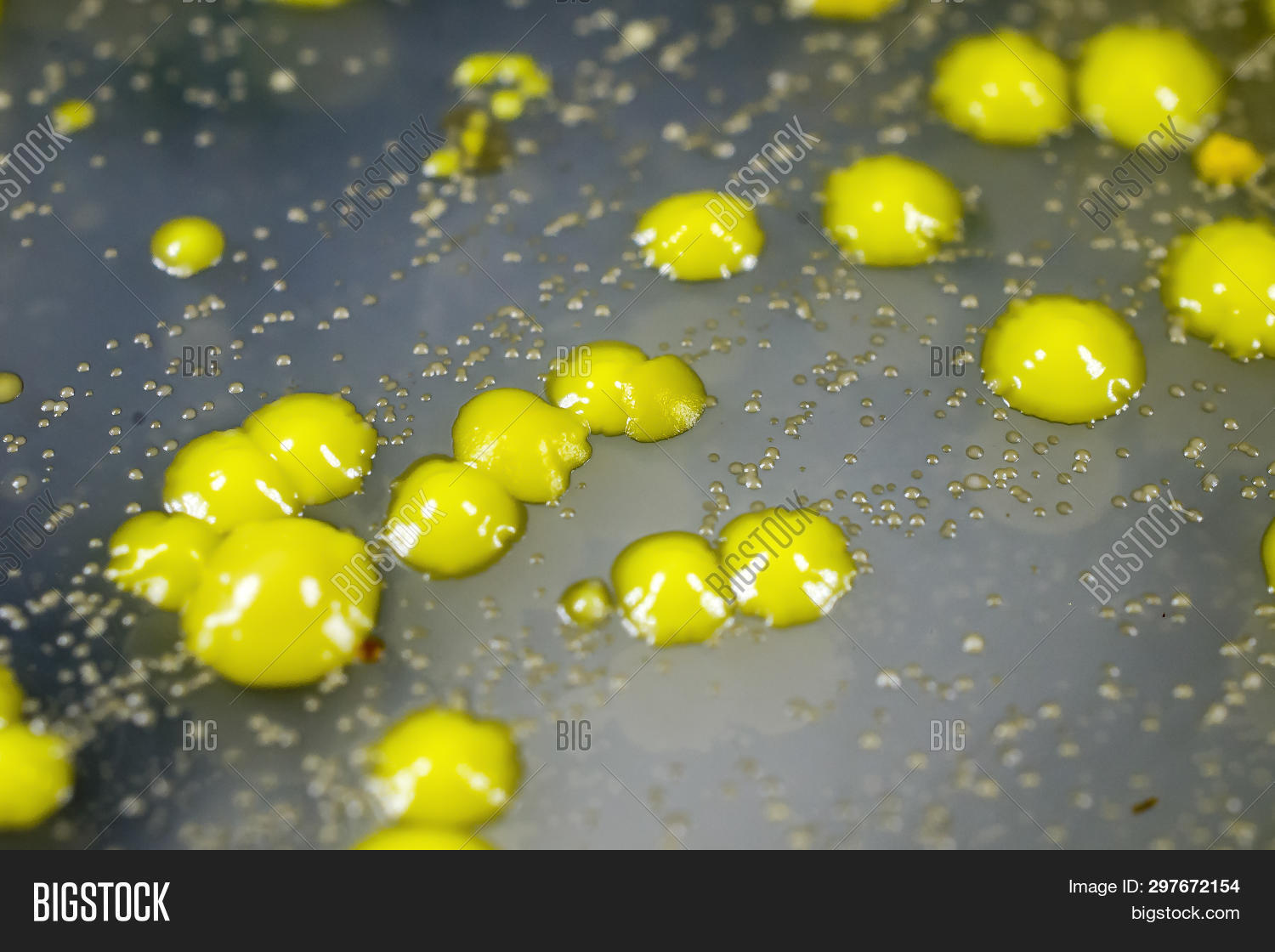 Bacteria Grown From Skin Smear, Colonies Of Micrococcus Luteus And ...