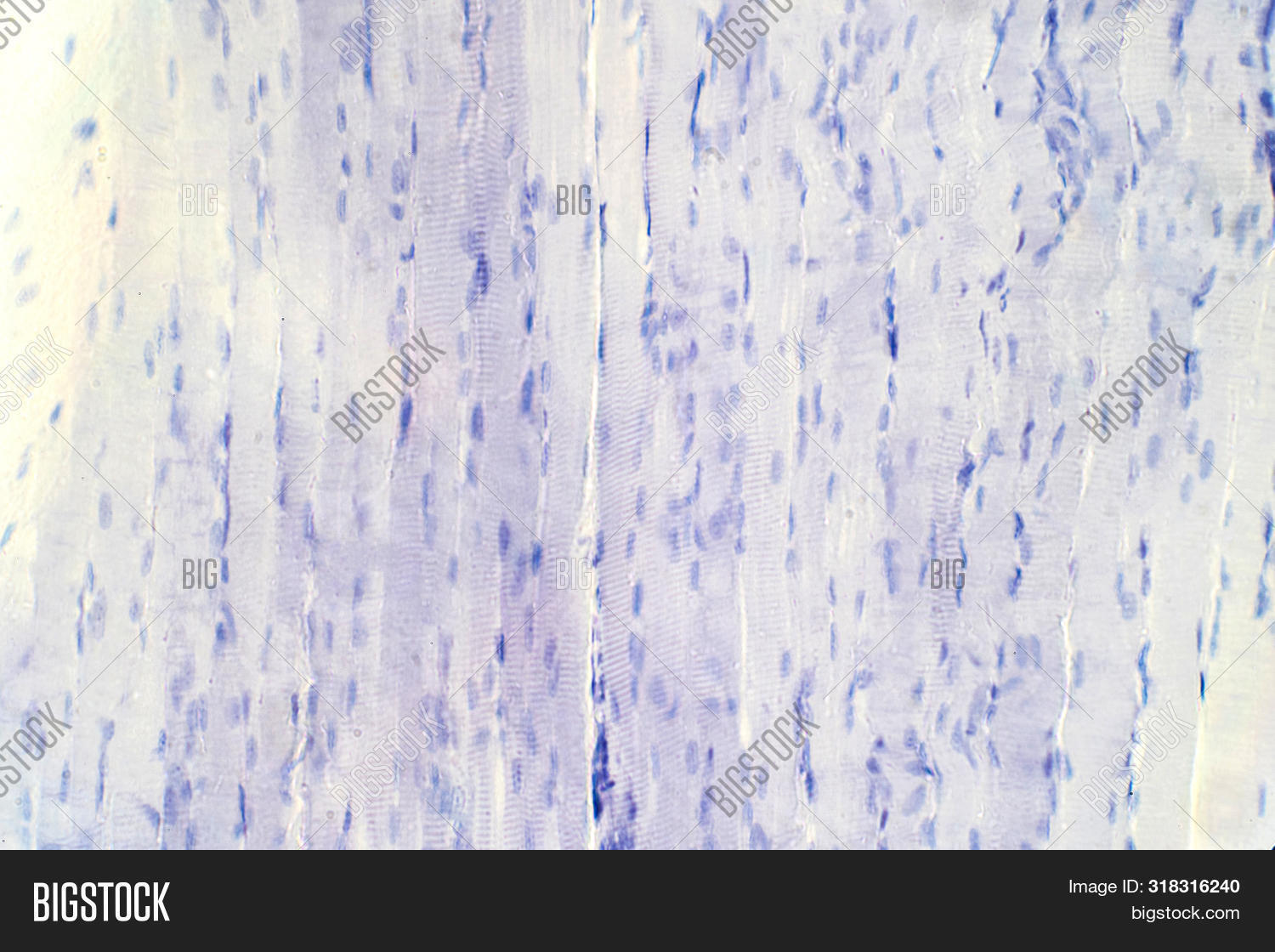 Human Skeletal Muscle Tissue Under Microscope View For Education ...