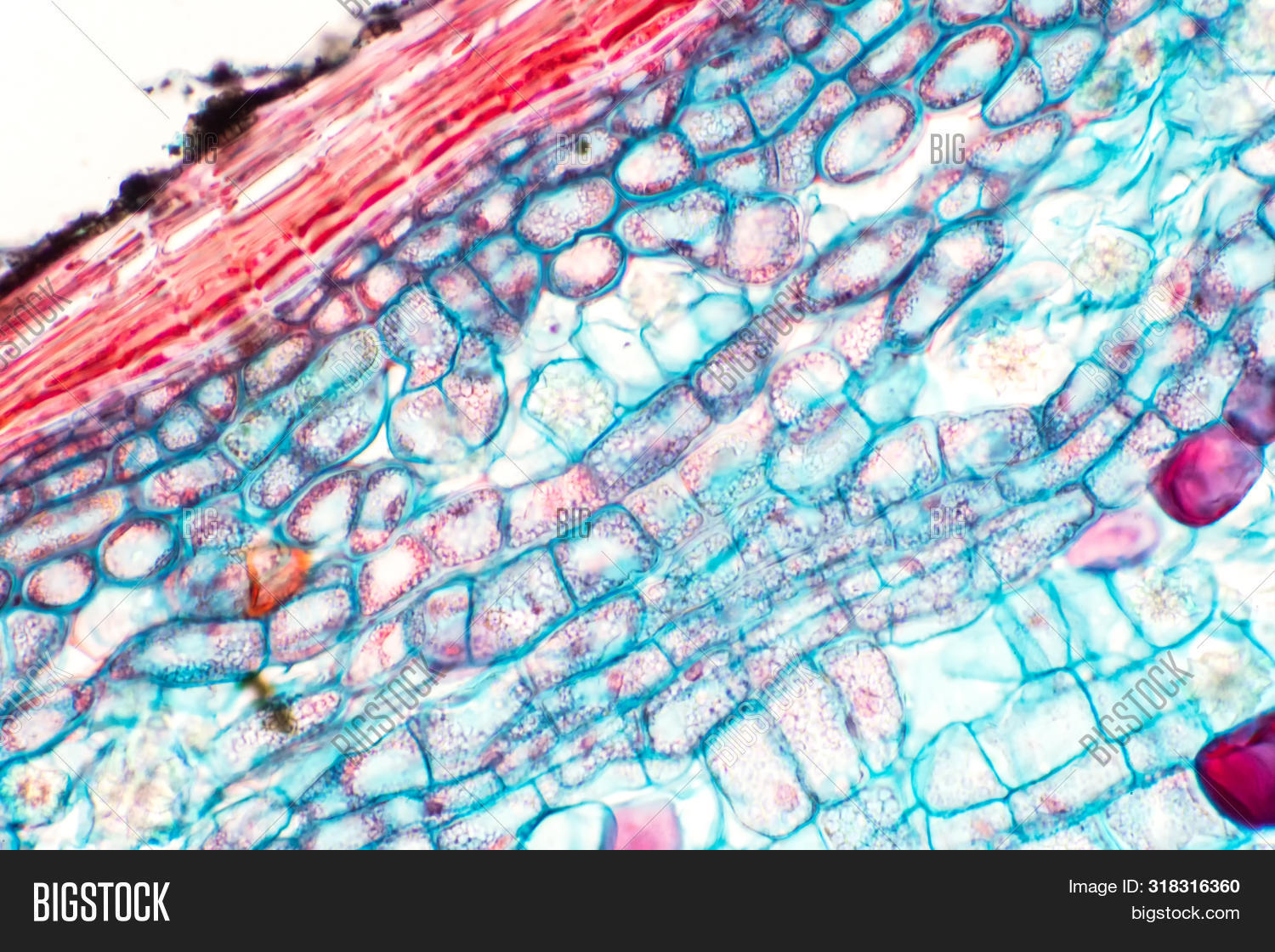 Cross Sections Of Plant Stem Under Microscope View Show Structure Of ...