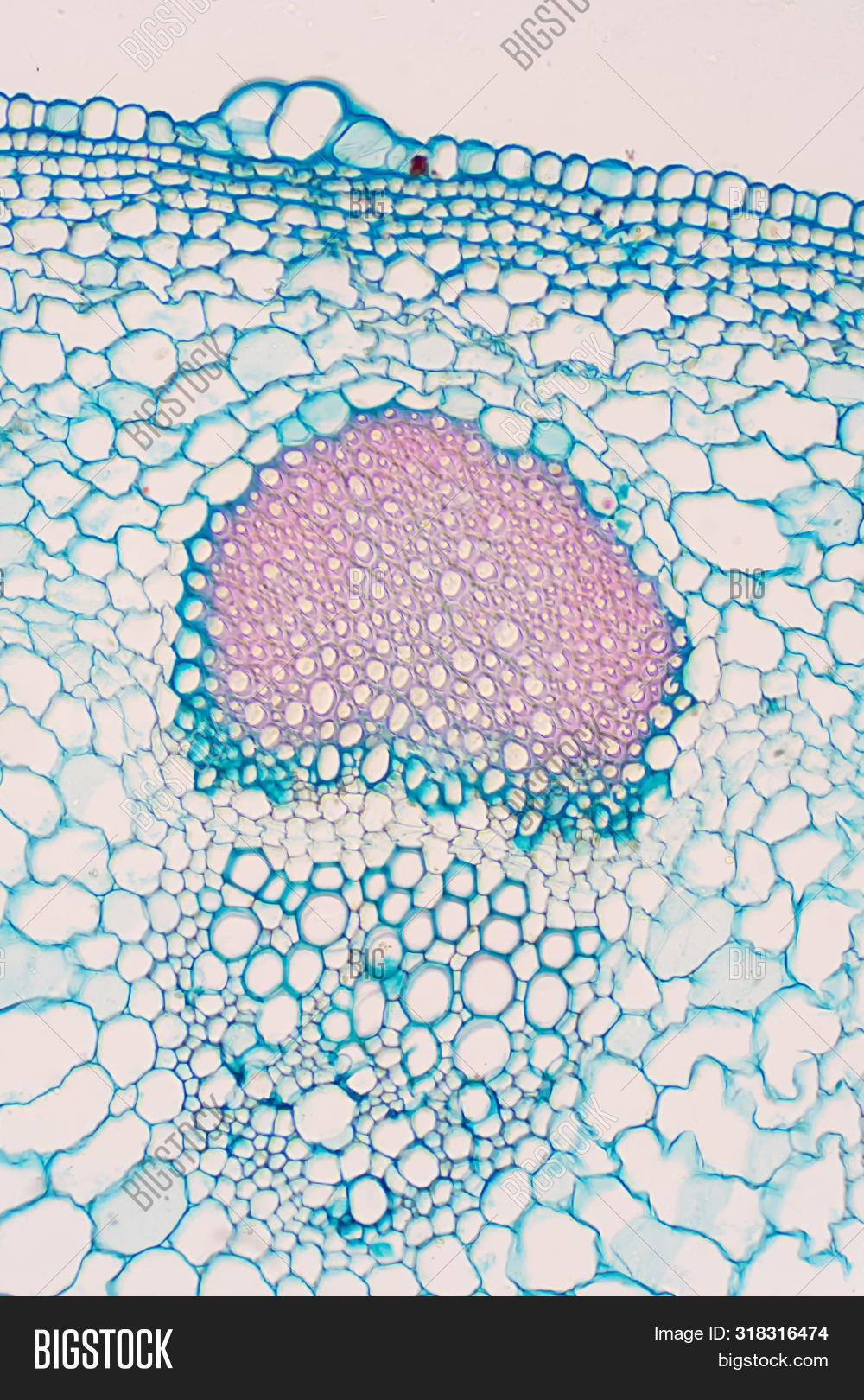 Cross Sections Of Plants Stem Show Plant Vascular Tissue Under ...