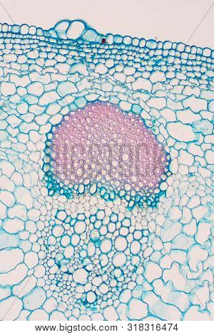 Cross Sections Of Plants Stem Show Plant Vascular Tissue Under ...