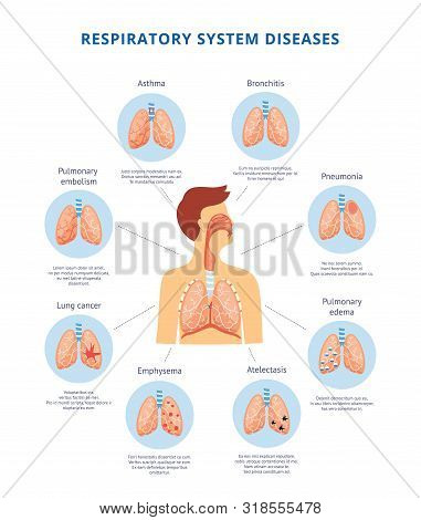 Human Respiratory System Diseases Informative Diagram Vector ...