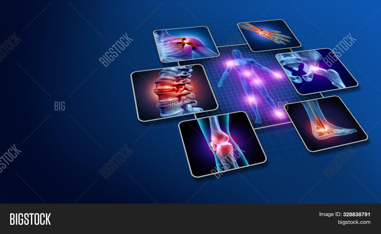Body Joint Pain Concept As Human Skeleton And Muscle Anatomy Of The ...
