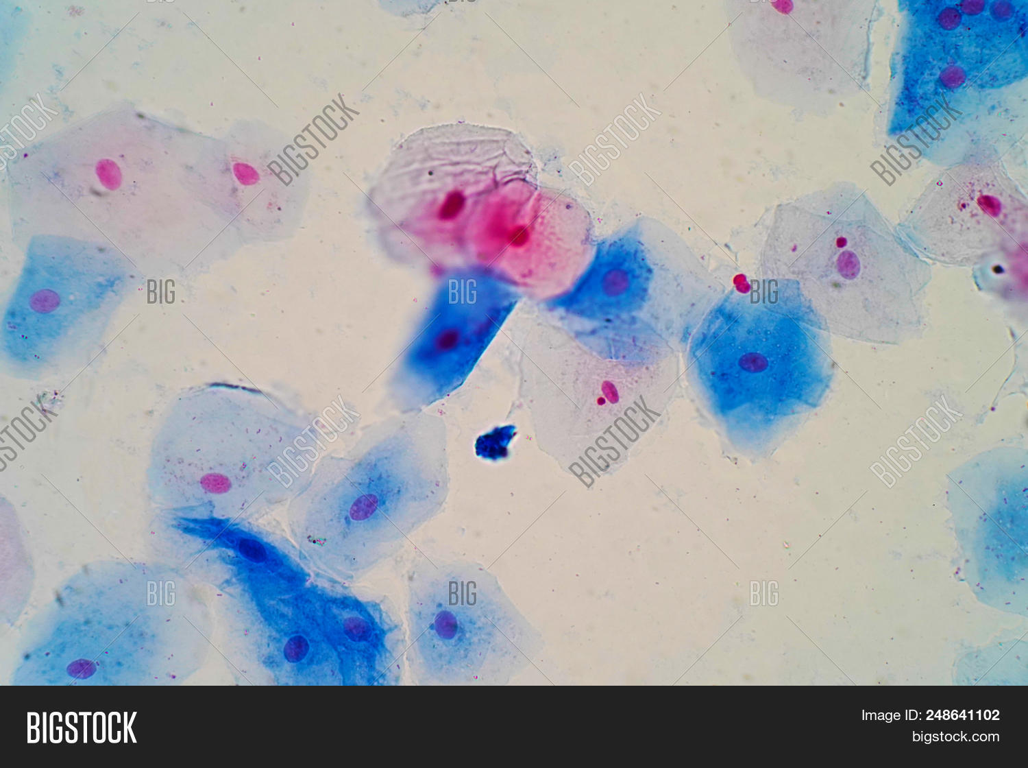 Squamous Epithelial Cells Under Microscope View For Education Histology ...