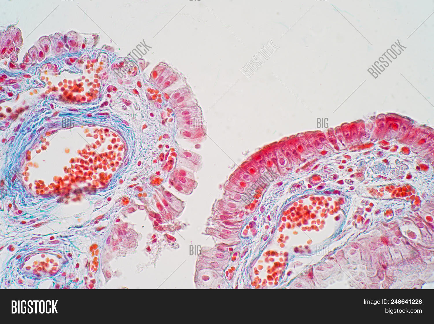 Simple Columnar Epithelium Is A Columnar Epithelium That Is Uni-layered ...