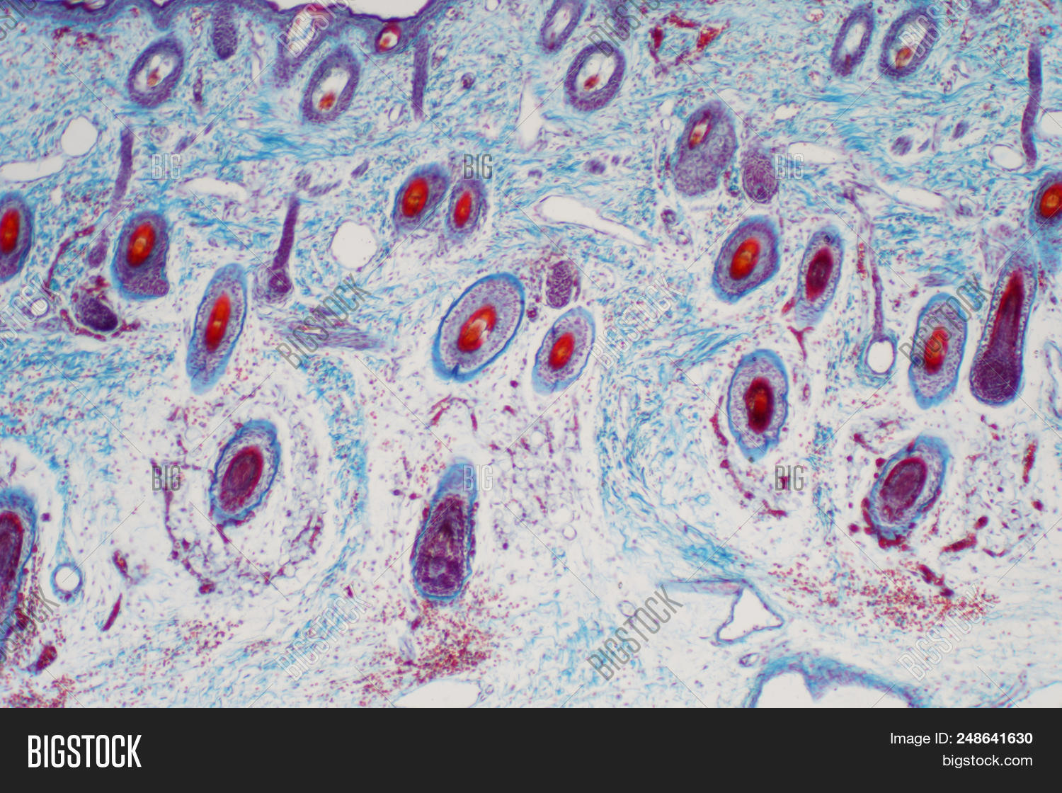 Cross Section Human Skin Tissue Under Microscope View For Education ...