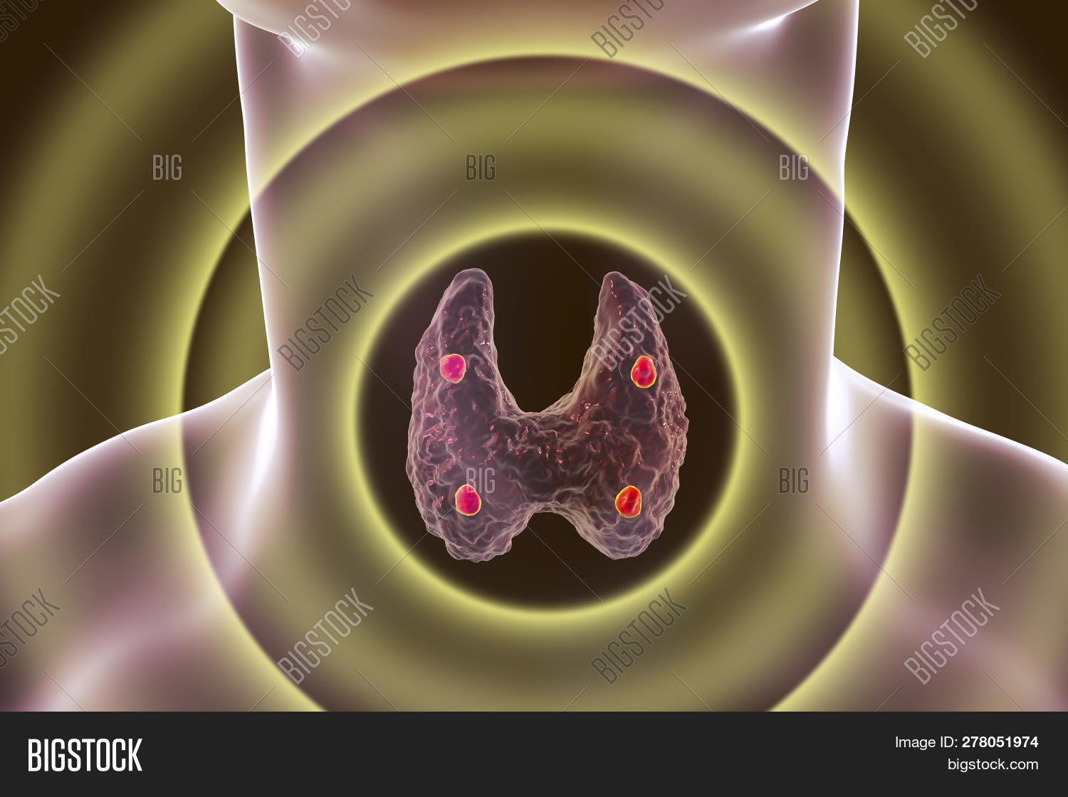 Parathyroid Glands And Thyroid Gland Anatomy, 3d Illustration image ...