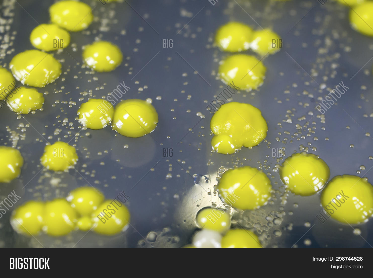 Bacteria Grown From Skin Smear, Colonies Of Micrococcus Luteus And ...