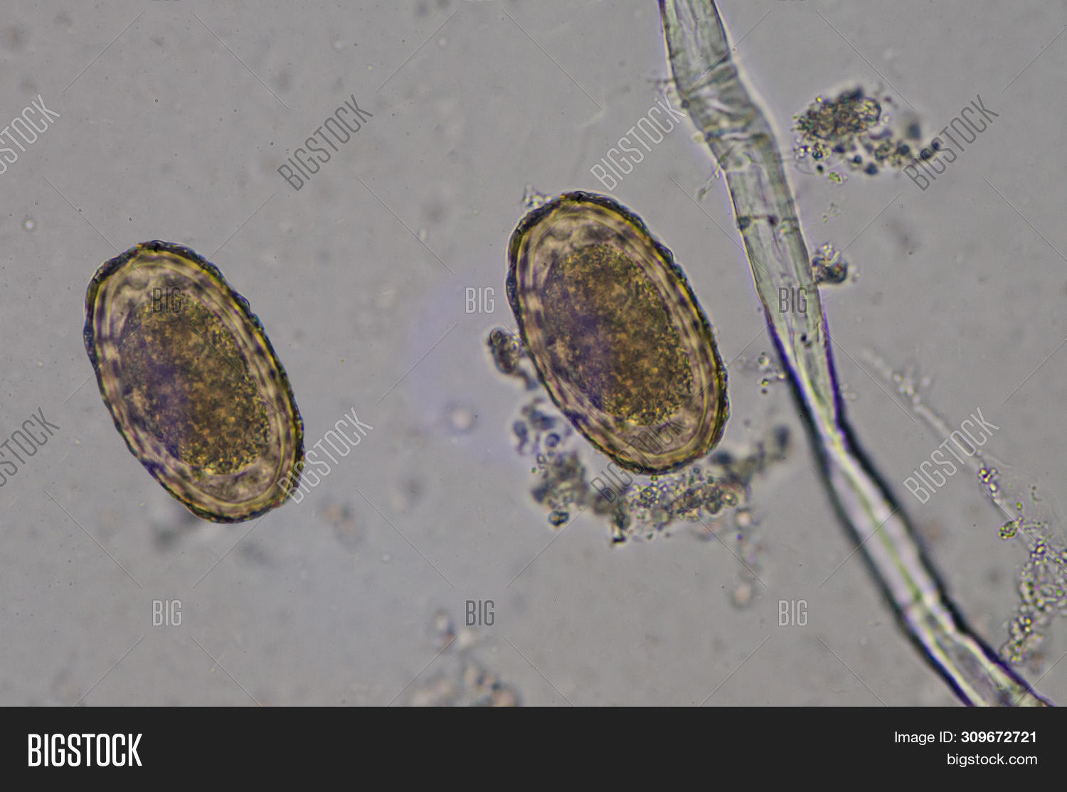 Parasite Egg Ascaris Lumbricoides Find With Microscope In Laboratory ...