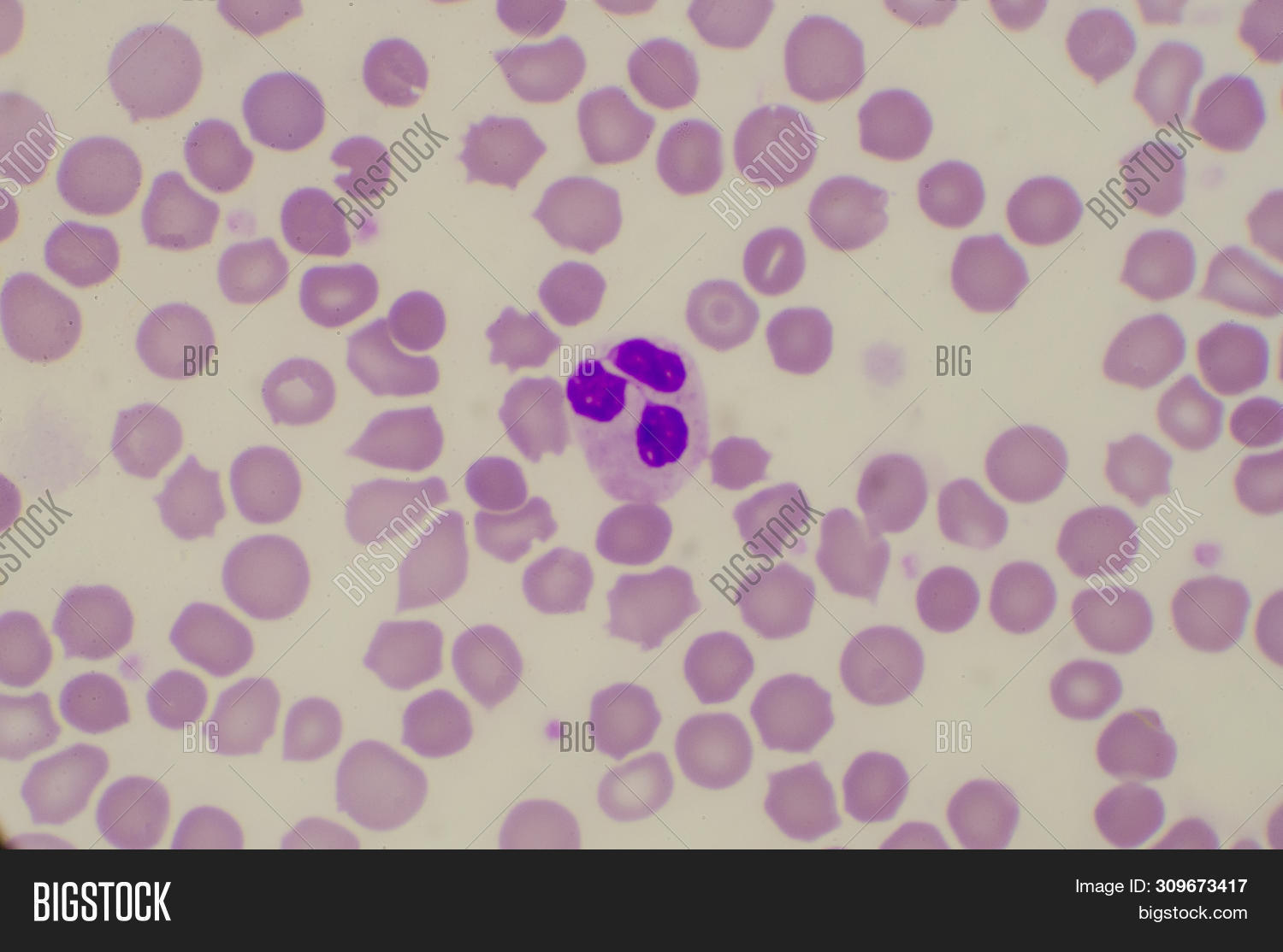 Close Up Normal Neutrophil On Red Blood Cells Background. image & stock ...