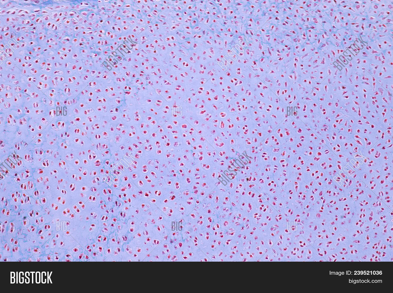 Cross Section Human Cartilage Bone Under Microscope View For Education ...