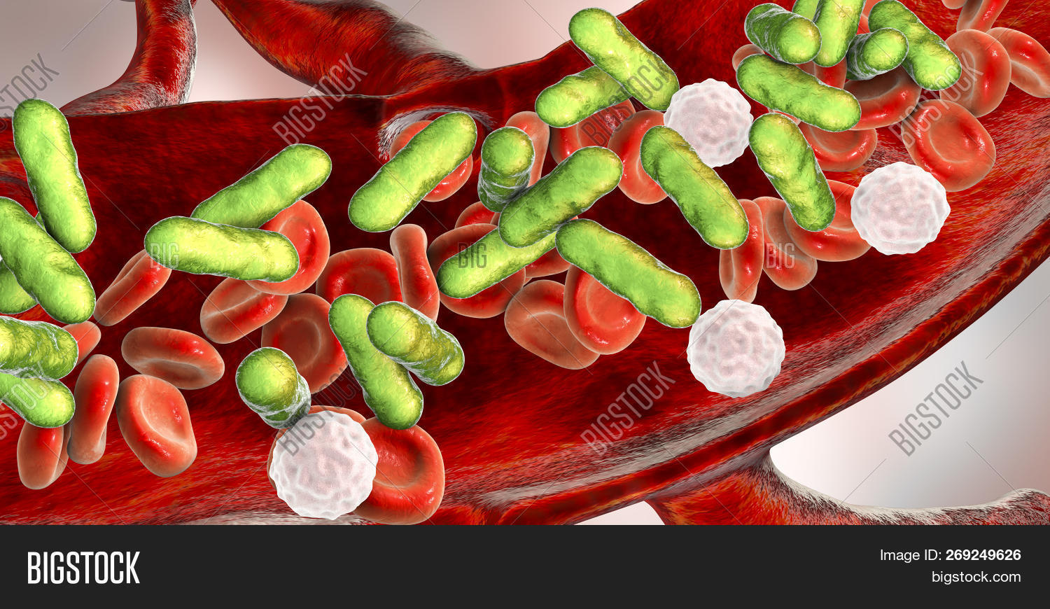 Sepsis, Bacteria In Blood. 3d Illustration Showing Rod-shaped Bacteria ...