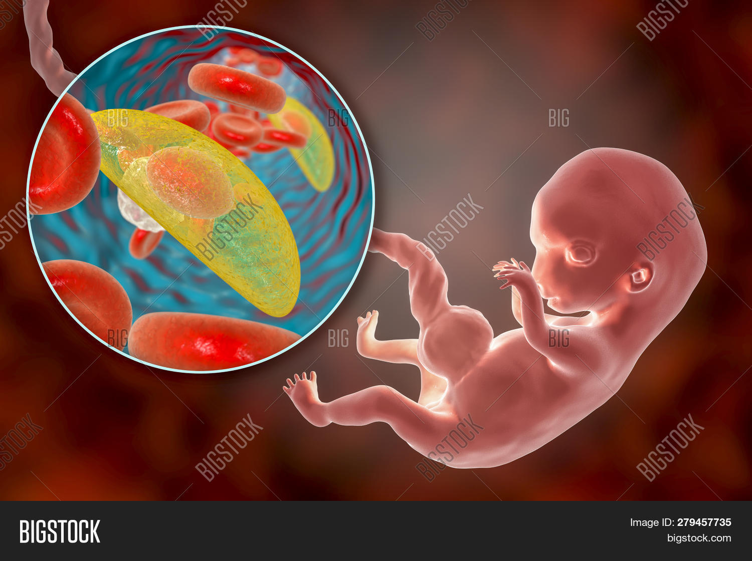 Transplacental Transmission Of Toxoplasma Gondii Parasites To Human ...