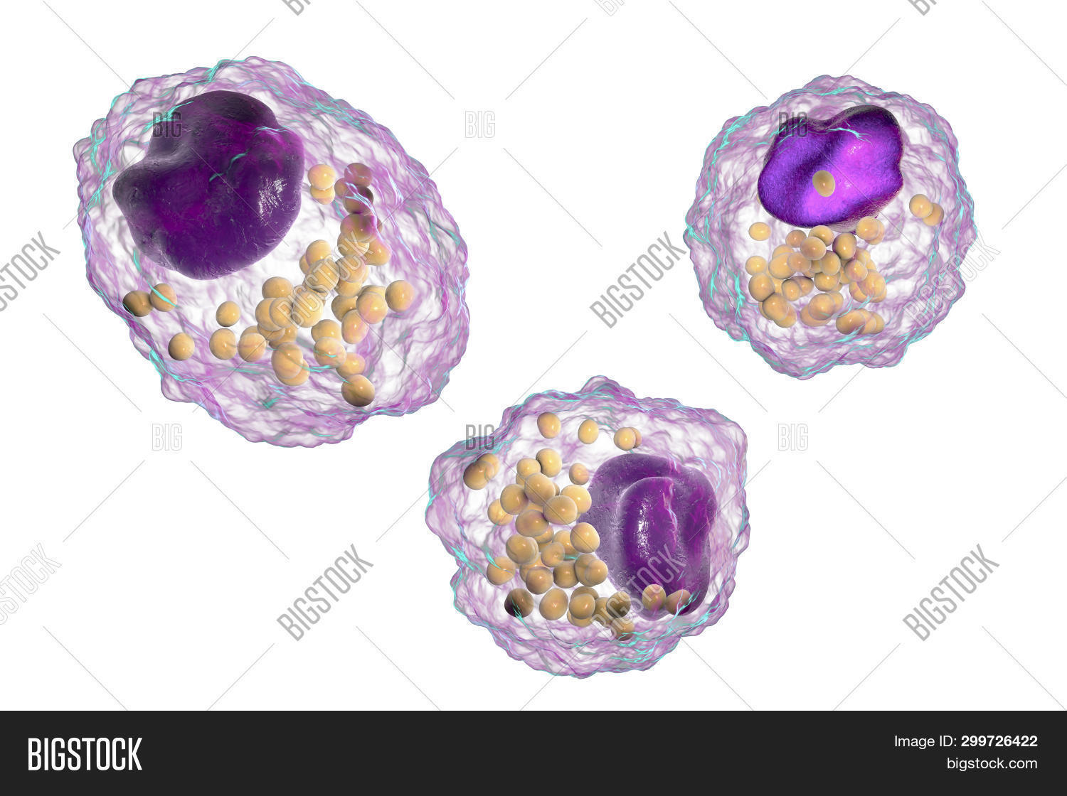 Foam Cell Macrophage Cells That Contain Lipid Droplets And Are
